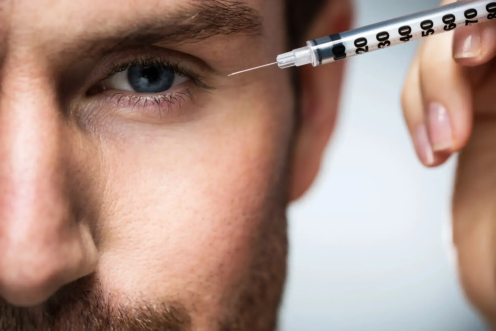 The 5 Best Botulinum Toxin Brands 2025